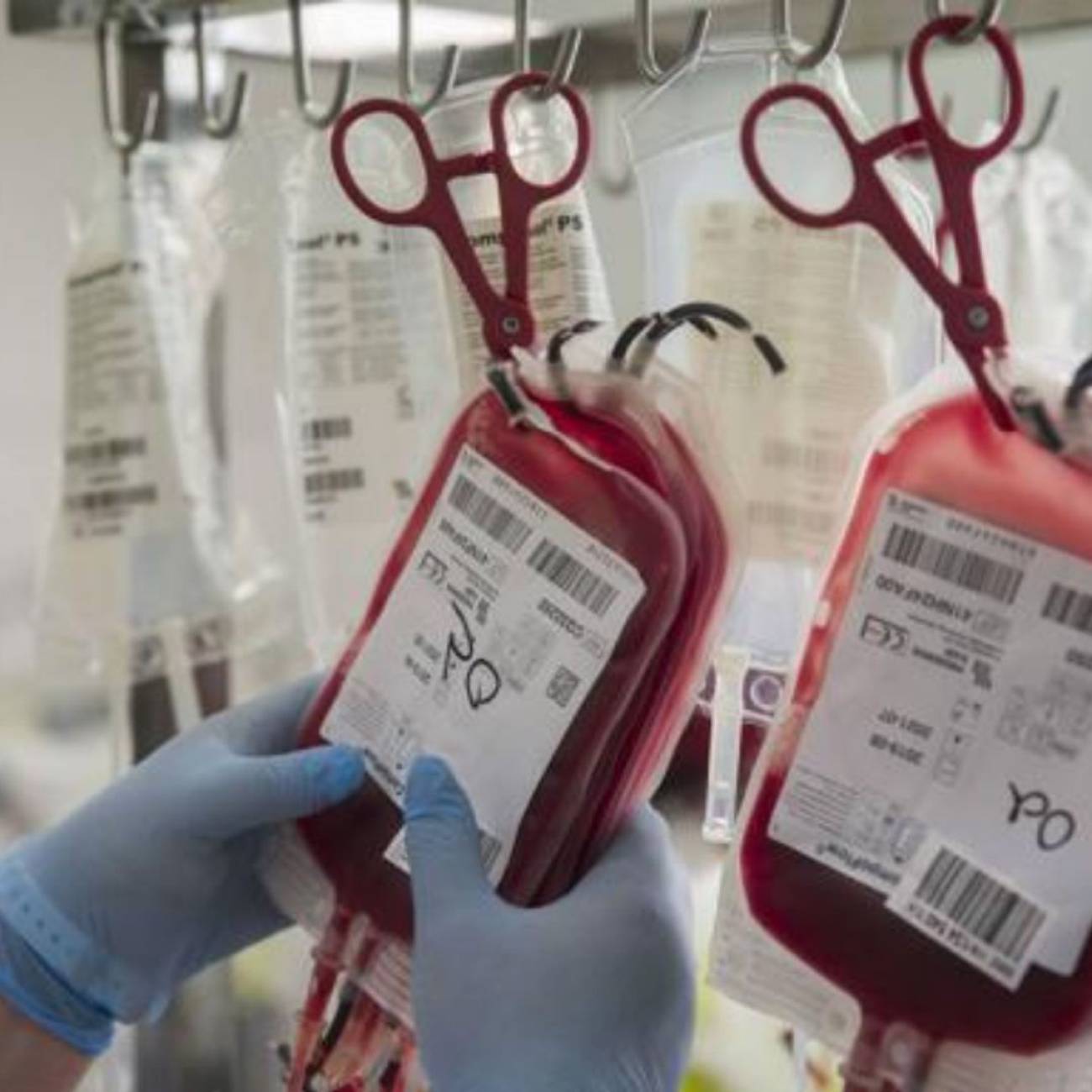 Alerta en los hospitales ante la falta de sangre para intervenciones ...